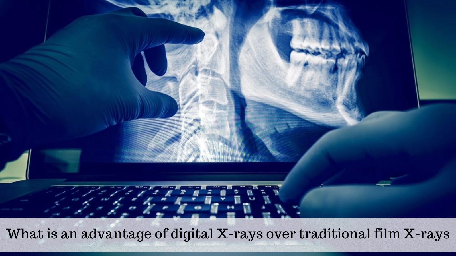 Advantage of Digital X-Rays: Faster, Safer, and Effective